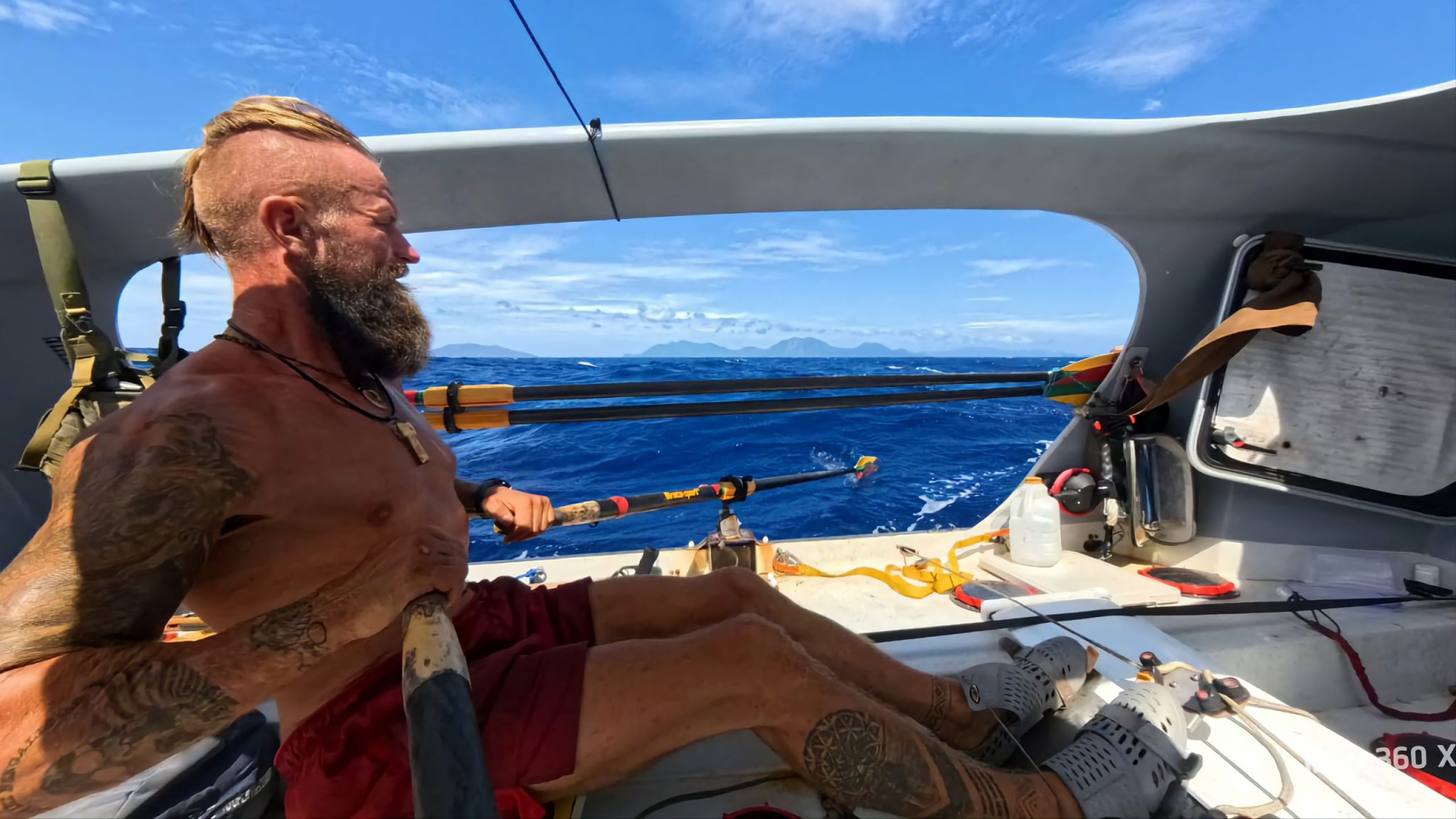 Kranto komanda praneša: po sėkmingos operacijos, Aurimas Mockus buvo ...